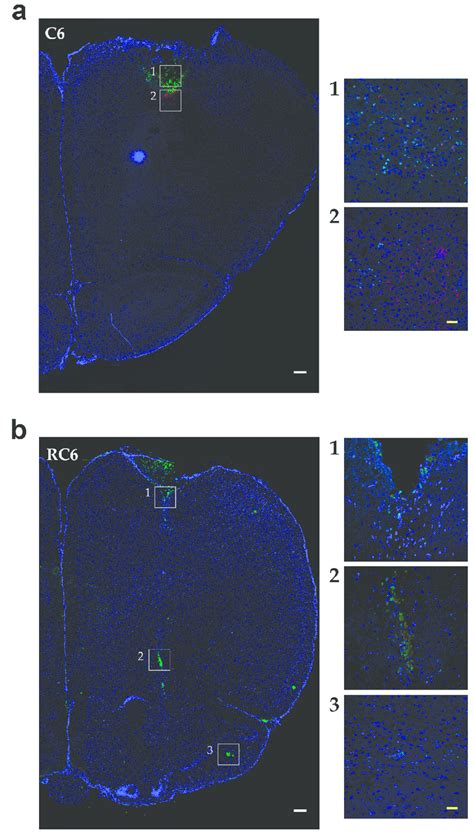 Invasion Of C6 And Rc6 Cells 25 Days After Inoculation A