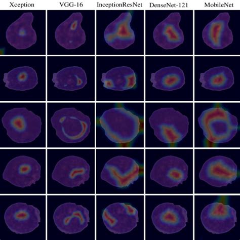The Visualization Of Gradient Class Activation Maps Grad Cam Of The