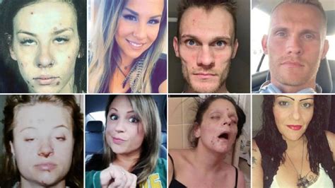 Inspiring Photos Show Drug Users Before And After They Got Clean