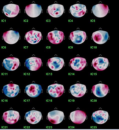 Identification Of Right Ica Components To Remove Brainstorm