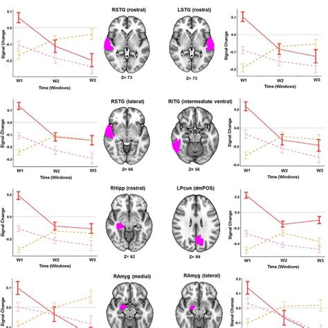 Temporal Behavior Of Rois With Significant Condition By Time