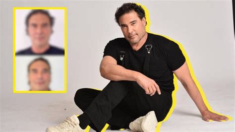 Video Así Luce Eduardo Yañez Tras Su Rejuvenecimiento Facial Mvs