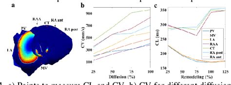 Figure 1 From Substrate Specific Simulations Of Atrial Fibrillation