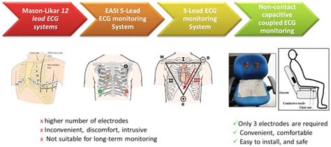 Mobile Cloud Computing Based Healthcare Service By Noncontact Ecg