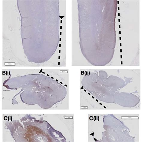 Hmgb1 Staining Of Tissue Post Ablation A 50w For 30s B 50w For Download Scientific