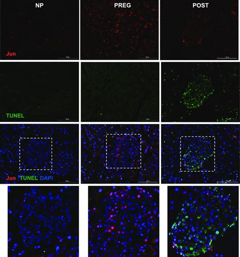 Apoptotic B Cells Are Mutually Exclusive With Jun B Cells Download Scientific Diagram