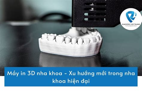 Máy in D nha khoa Xu hướng mới trong nha khoa hiện đại