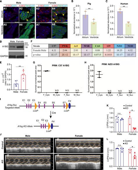 Cardiac Proteomics Reveals Sex Chromosome Dependent Differences Between Males And Females That
