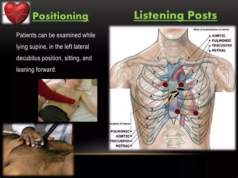 Heart Sounds And Murmurs Ppt