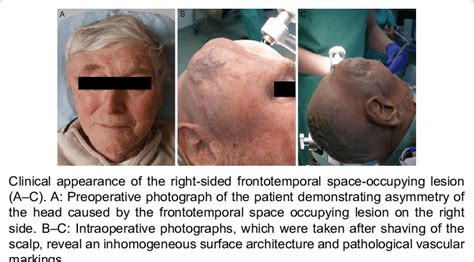 Clinical Appearance Download Scientific Diagram