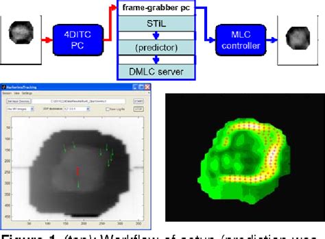Figure 1 From Real Time Markerless Tumor Tracking With Mv Imaging And A Dmlc Semantic Scholar