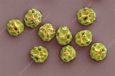 Dandelion Pollen Grains Sem Stock Image C0084936 Science Photo