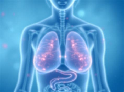 Mucinous Breast Carcinoma Md Searchlight