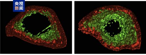 我国科学家突破灵长类抗衰老研究，工程化细胞实现多器官协同抗衰