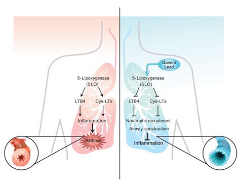 5-Lipoxygenase Inhibitor | Qurient