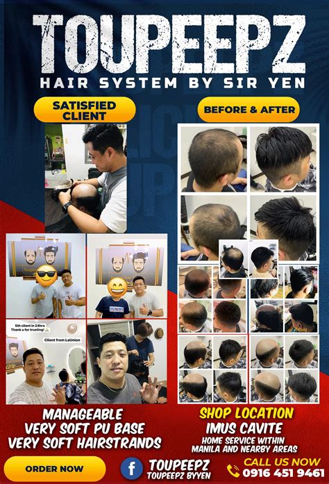 Scalp Solution Ph Added A New Photo Scalp Solution Ph Scalp Solution Ph Added A New Photo Scalp Solution Ph