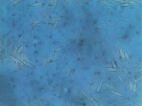 Microscopic Examination Of The Morphology M Gypseum Fusiform Download Scientific Diagram
