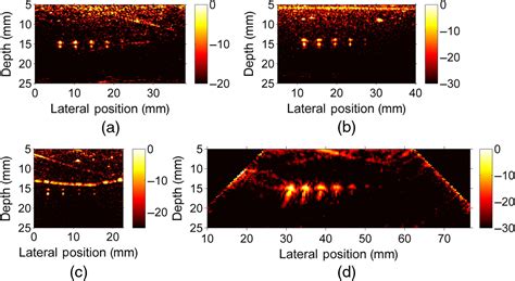 Phantom Based Image Quality Test Methods For Photoacoustic Imaging Systems
