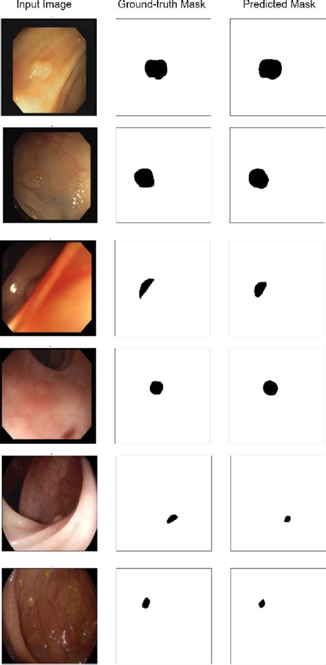 Figure 3 From Polylite A Lightweight Transformer With Multi Scale Attention For Colorectal