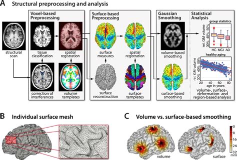 the preprocessing of structural mris often contains a voxel based part