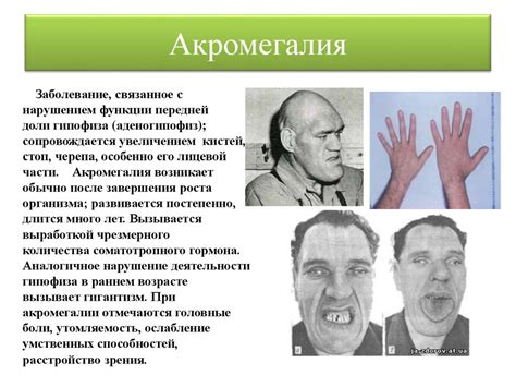 Гипофиз Голотопия Скелетотопия Синтопия презентация онлайн