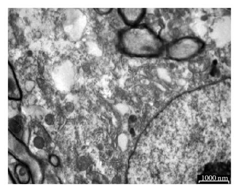 Electron Micrographs Of Motoneuronal Mitochondria In The Spinal Cord Of