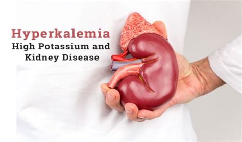 Hyperkalemia Causes Symptoms And Treatment Options