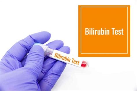 Bilirubin Test About Purpose Uses Interpretation More A2Z Healthy