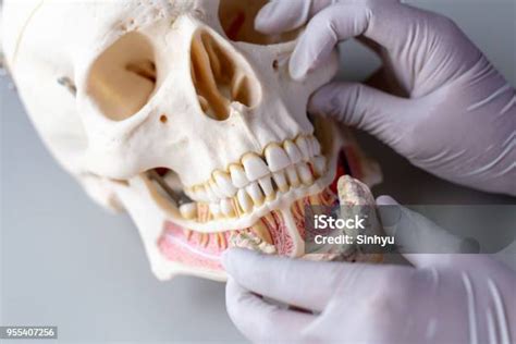연구 진단 캐스트 및 치과 실험실에서 치과 석고 모델의 캐스팅 개념에 대한 스톡 사진 및 기타 이미지 개념 건강 진단
