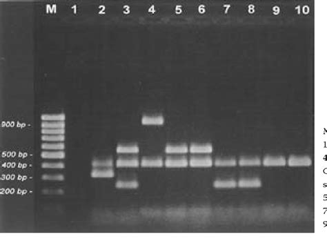 Figure 1 From Typing Of Isolates Of Clostridium Perfringens From