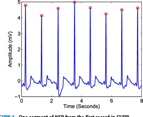 Figure 3 From Life Threatening Ventricular Arrhythmia Detection With