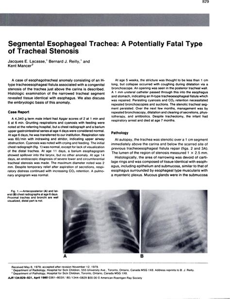 Segmental Esophageal Trachea A Potentially Fatal Type Of Tracheal Stenosis Ajr