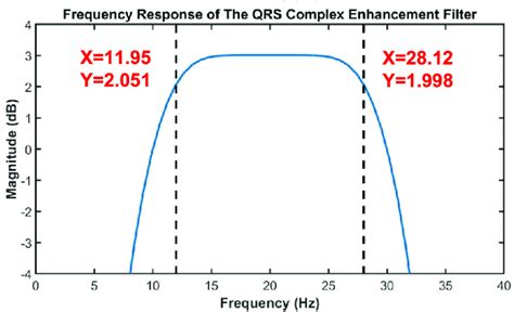 Frequency Response Of The Qrs Complex Enhancement Filter Download
