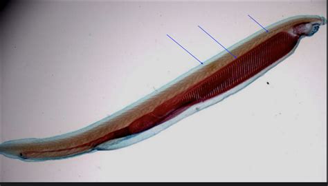 Amphioxus Lateral View Diagram Quizlet