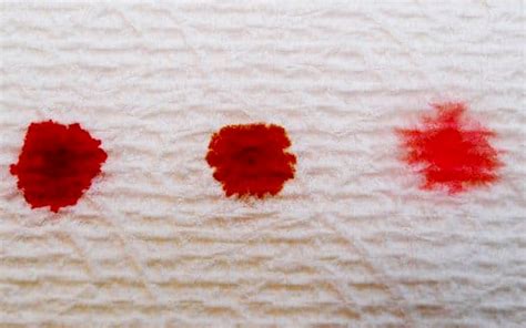 The Difference Between Implantation And Menstruation Nestia