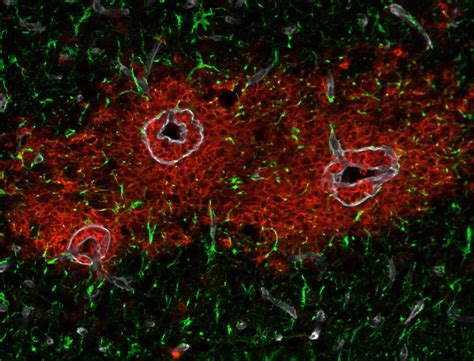 Recent Research Uncovers Mystery Of The Blood Brain Barrier Scitechpost