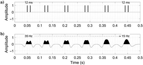 Nonstationary Differential Resolution An Algorithm To Improve Seismic