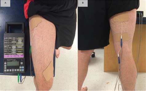 Influence Of Patterned Electrical Neuromuscular Stimulation On Quadriceps Activation In