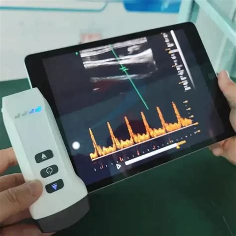 Usb Convex Wireless Ultrasound Scanner Wifi Usg Ultrasound Probe Wireless Ultrasound And