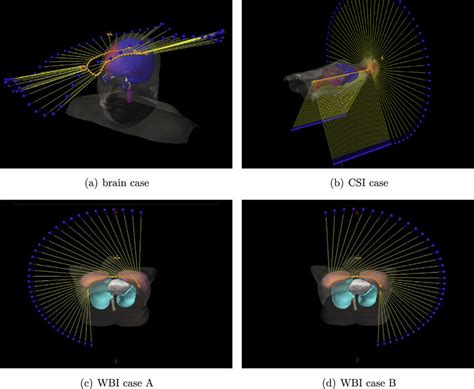 Illustrations Of The Paths In Eclipse Tps For The Dtrt Plan With