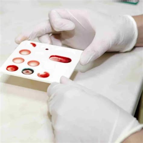 Bicarbonate Serum Test Price In Delhi Cost Near Me India Ganesh Diagnostic