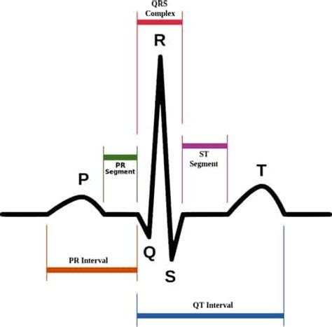 Understanding An Ecg Ecg Interpretation Geeky Medics How I Learned To