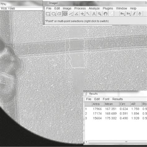 Representative Image Of Area Measurement In Imagej Software Download