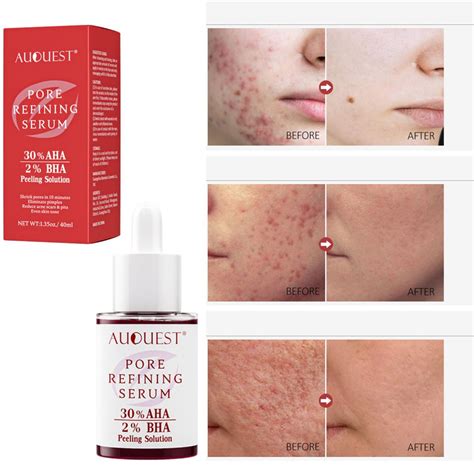 20% AHA Комплекс фруктовых кислот 2% BHA Салициловая кислота Сыворотка ...