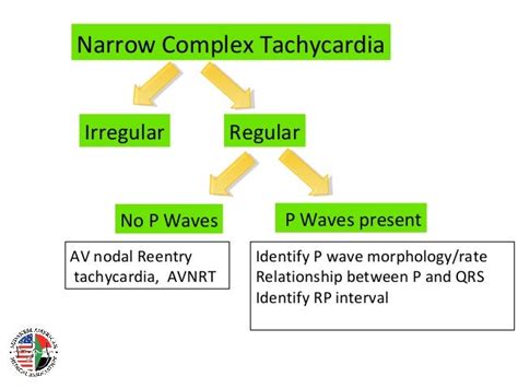 Narrow Complex Tachycardias