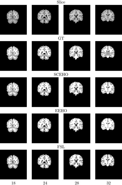 visual results of hmrf sceho hmrf eeho and fsl download scientific