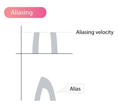 Figure 1 Ecg Characteristics And Differences Between Normal Conduction