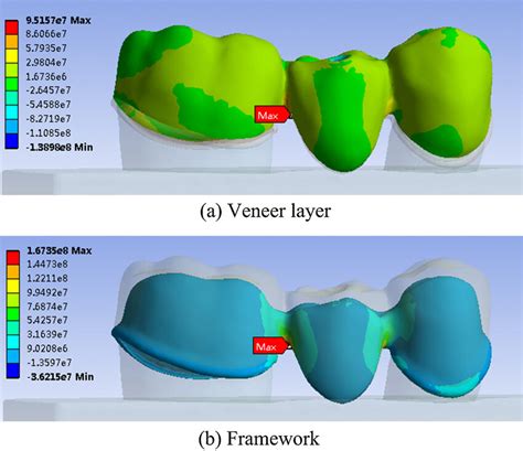 First Principle Stress Distribution Of A Veneer Layer And B Download Scientific Diagram