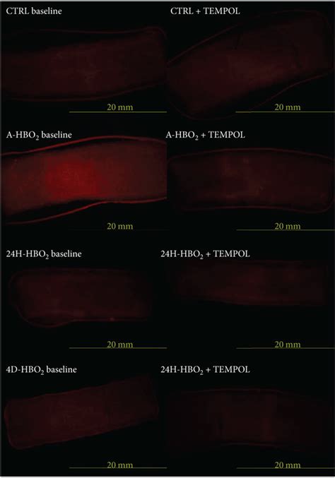 A Dhe Superoxide Fluorescence Intensity Measurement In The Rat