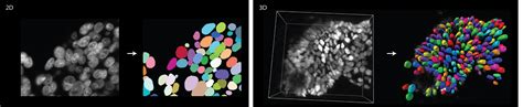 stardist imagej biii